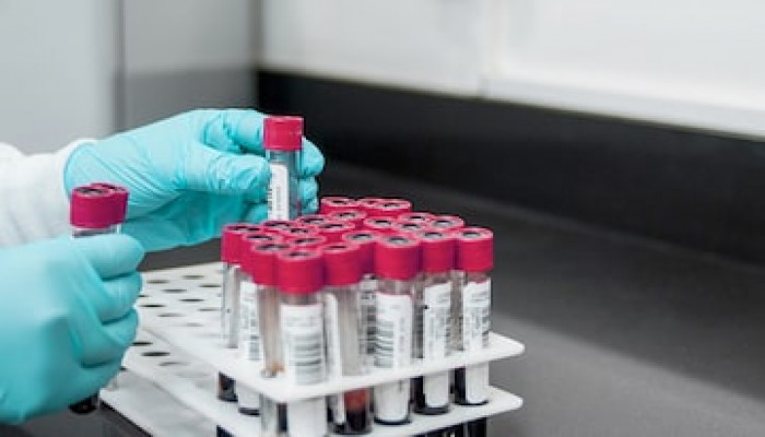 Lab-grown blood given to people in world-first clinical trial